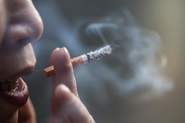 How are periodontal disease and smoking habit? - Dr Fernandez ...