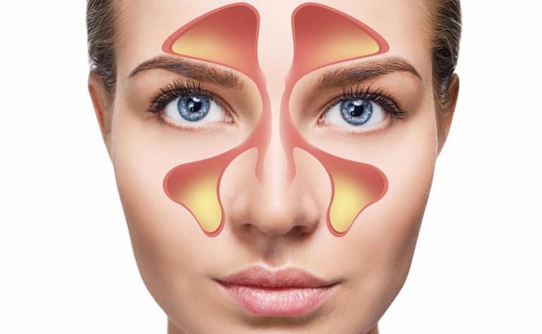 ¿Cuándo es necesaria la elevación de seno maxilar?